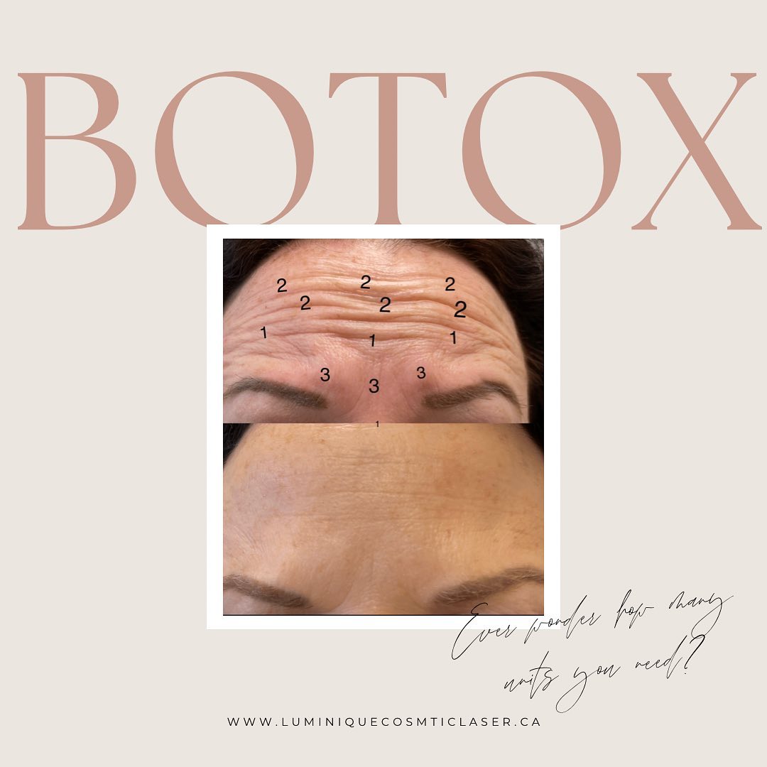 Top 5 Botox Clinics in Saskatoon, SK [2025]
